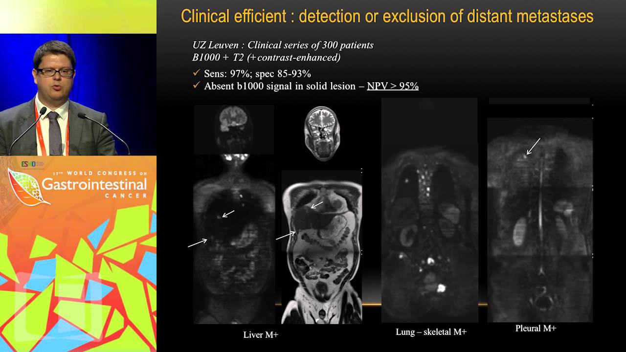 Keynote Lecture 5: The value of whole body diffusion-weighted MRI for ...