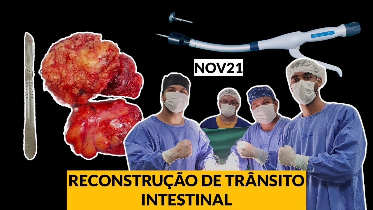 Reconstrução de Trânsito Intestinal • Bowel Transit Reconstruction - DR ...