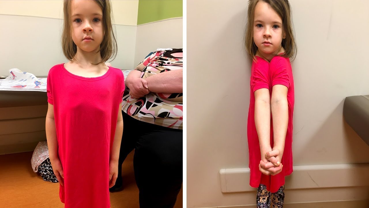 Esta Increíble Niña Nació SIN CLAVÍCULA - YouTube