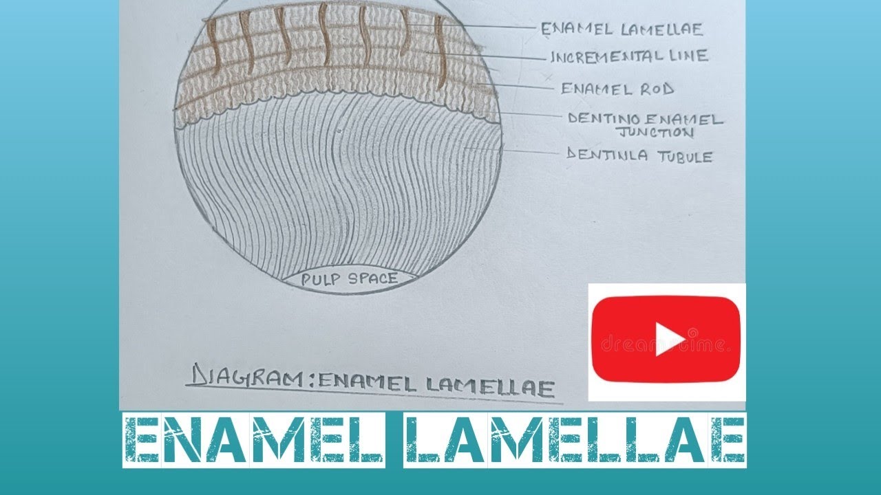 Right Way To Draw Enamel Lamellae - YouTube
