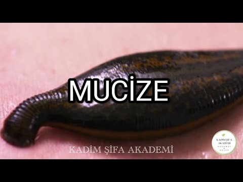 Dolaşım Sistemi ve Sülük Tedavisi | Sülüğün Kan Dolaşımına Etkisi Nedir?
