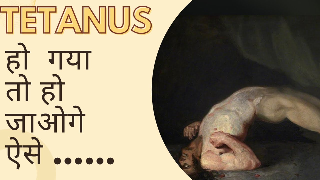 Complete guide of Tetanus । Tetanus Disease । Tetanus Vaccine ...