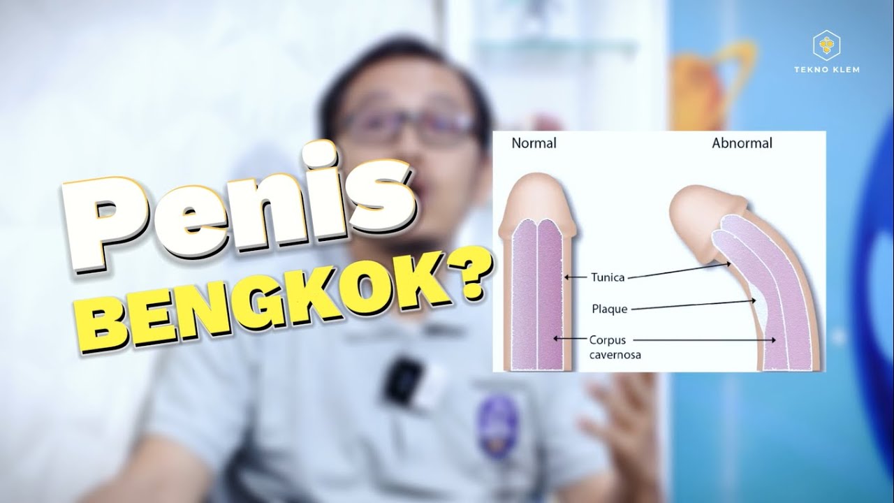 KONTEN DEWASA | Penis Bengkok Bisa Disunat? Bisa Berhubungan Intim? Ini ...