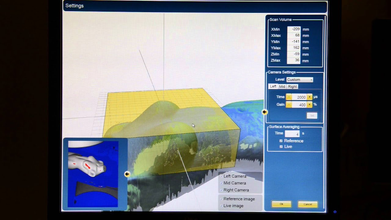 cPosition settings (C-Rad Catalyst HD) - YouTube