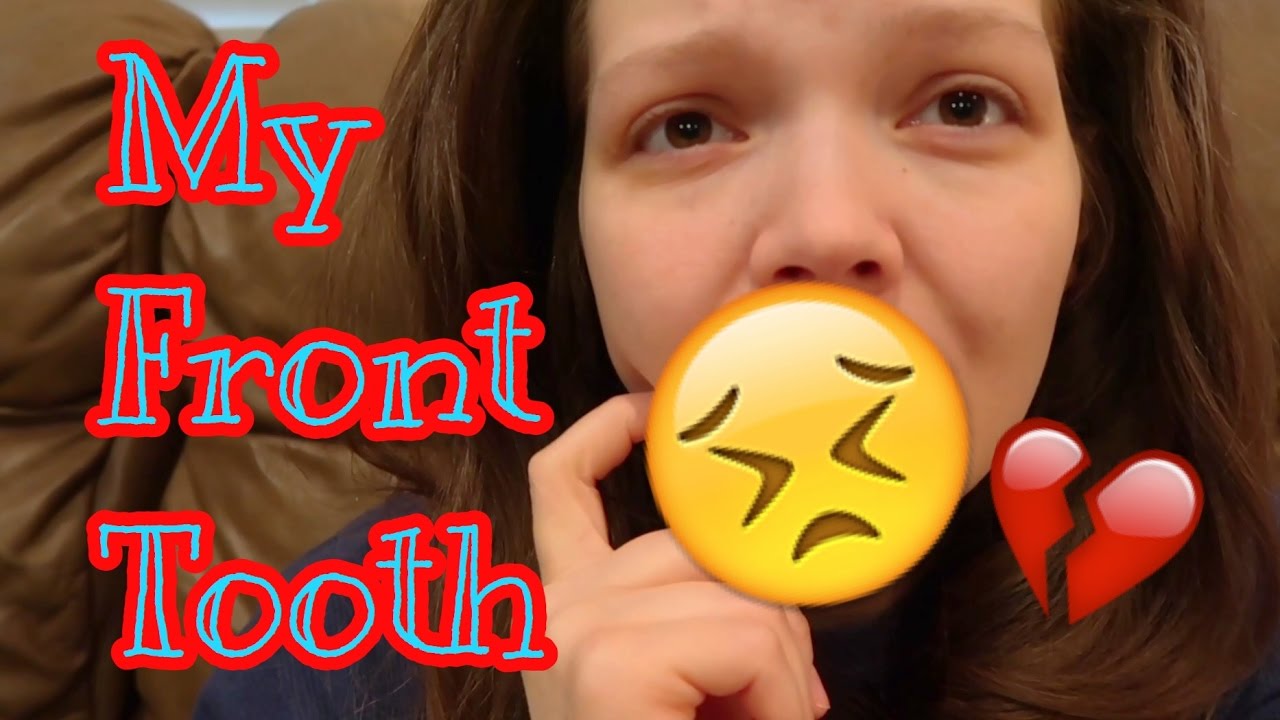 MY TOP FRONT TOOTH BROKE IN HALF! (I guess my teeth COULD get worse 😢 ...