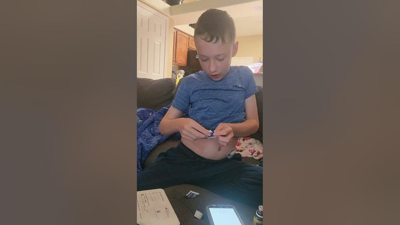 how to change a dexcom g6 sensor - YouTube