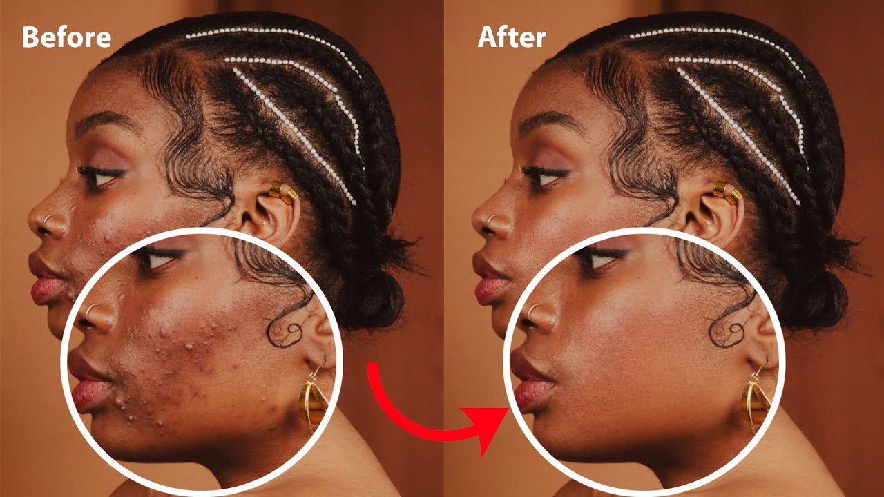 Learn This Secret To Maintain Realistic Skin Texture || Retouch Like a ...