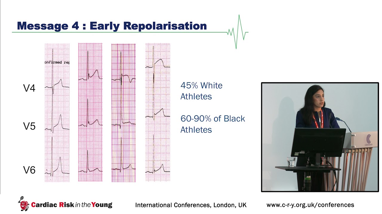 CRY Conference 2017 - The athlete's ECG - Dr Sabiha Gati - YouTube
