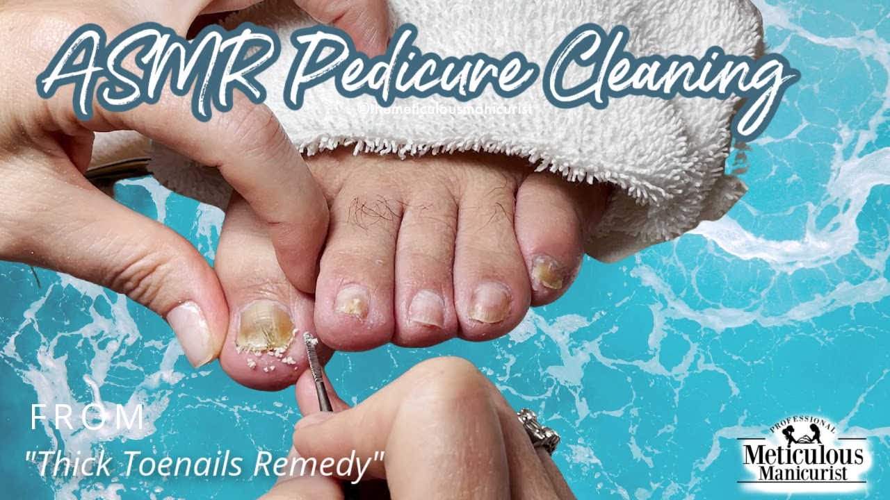 👣ASMR Pedicure Cleaning💆‍♀️Thick Toenails Remedy👣 - YouTube
