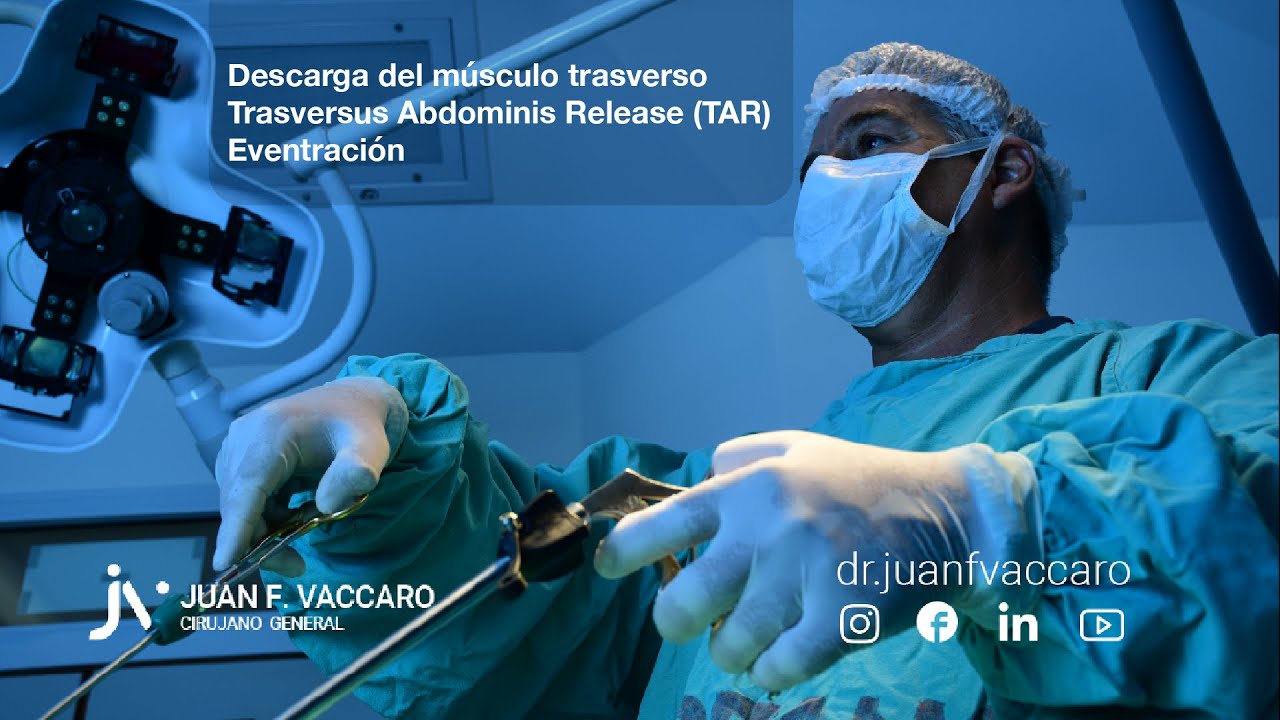 Descarga del músculo trasverso Trasversus Abdominis Release TAR ...
