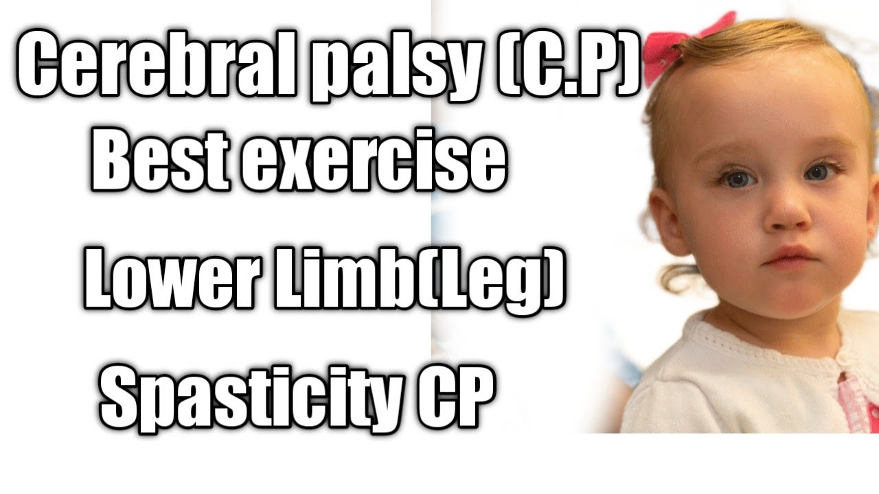 cerebral palsy (C.P)@drrohanphysiopt6186spasticity cp best exercise ...