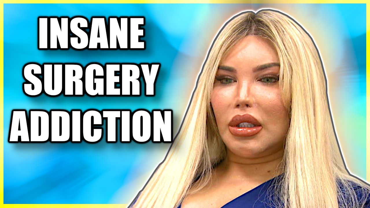 Worst Case Plastic Surgery Addiction | Botched Surgery Ruined Her Face ...