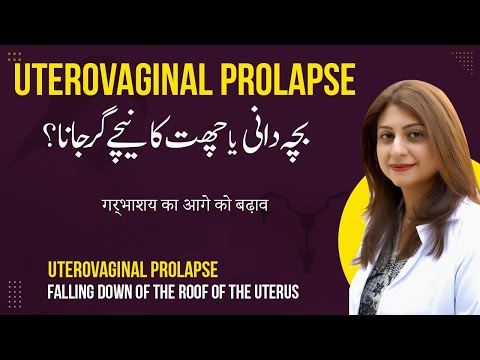 Bacha Dani Ya Chatt Ka Niche Gir Jana | Uterovaginal Prolapse in Urdu/Hindi