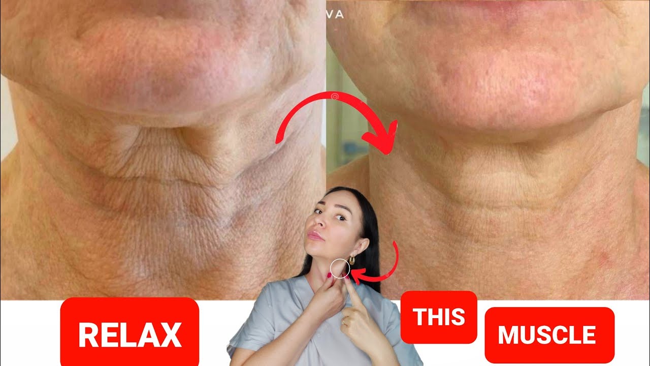 Relax this muscle to get rid of the TURKEY NECK and lengthen your neck ...