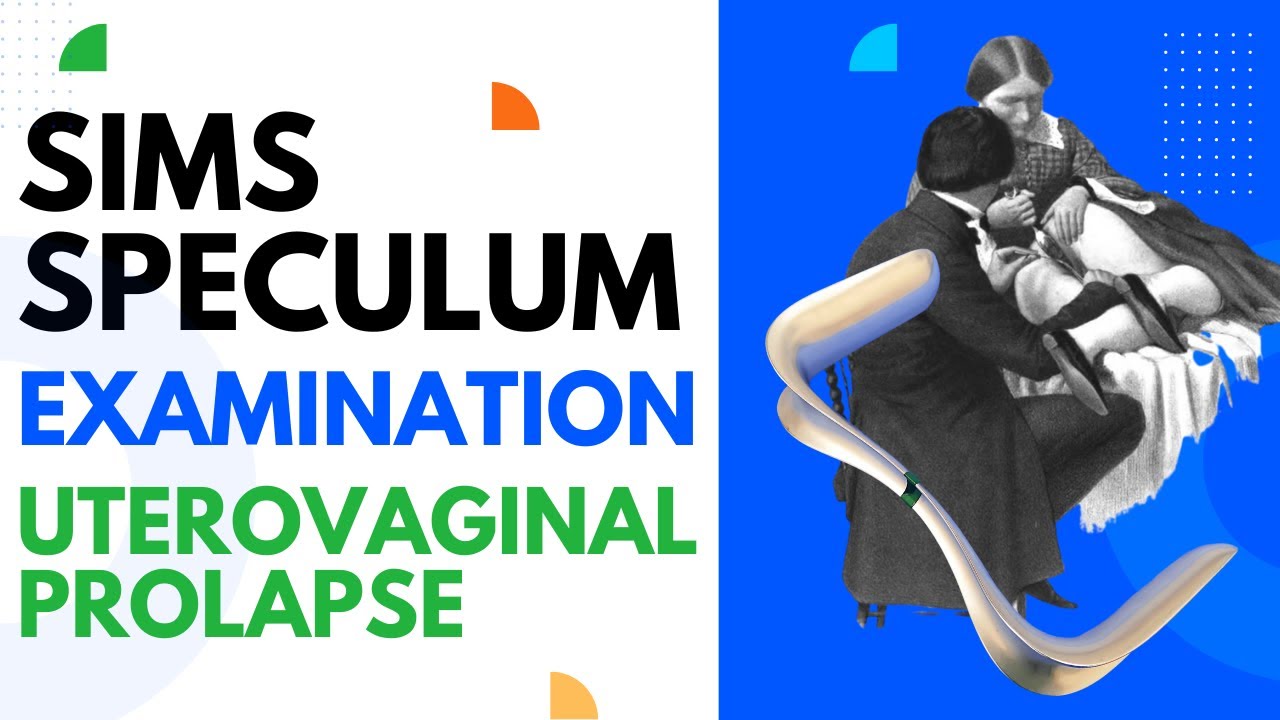 Sims Speculum Examination of Vagina for Uterovaginal Prolapse | Sims ...