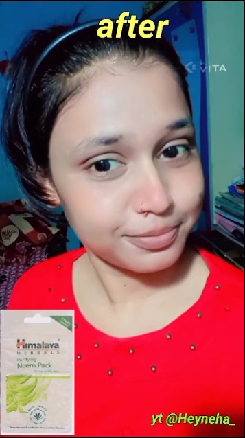 before/after magical results - YouTube