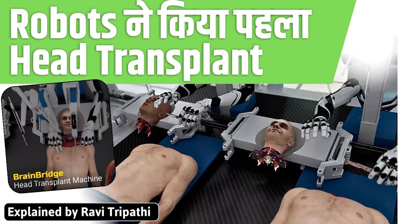 World's first head transplant robotic surgery successfull - YouTube