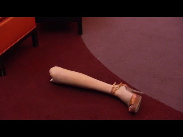 Aviva Drescher Prosthetic Leg