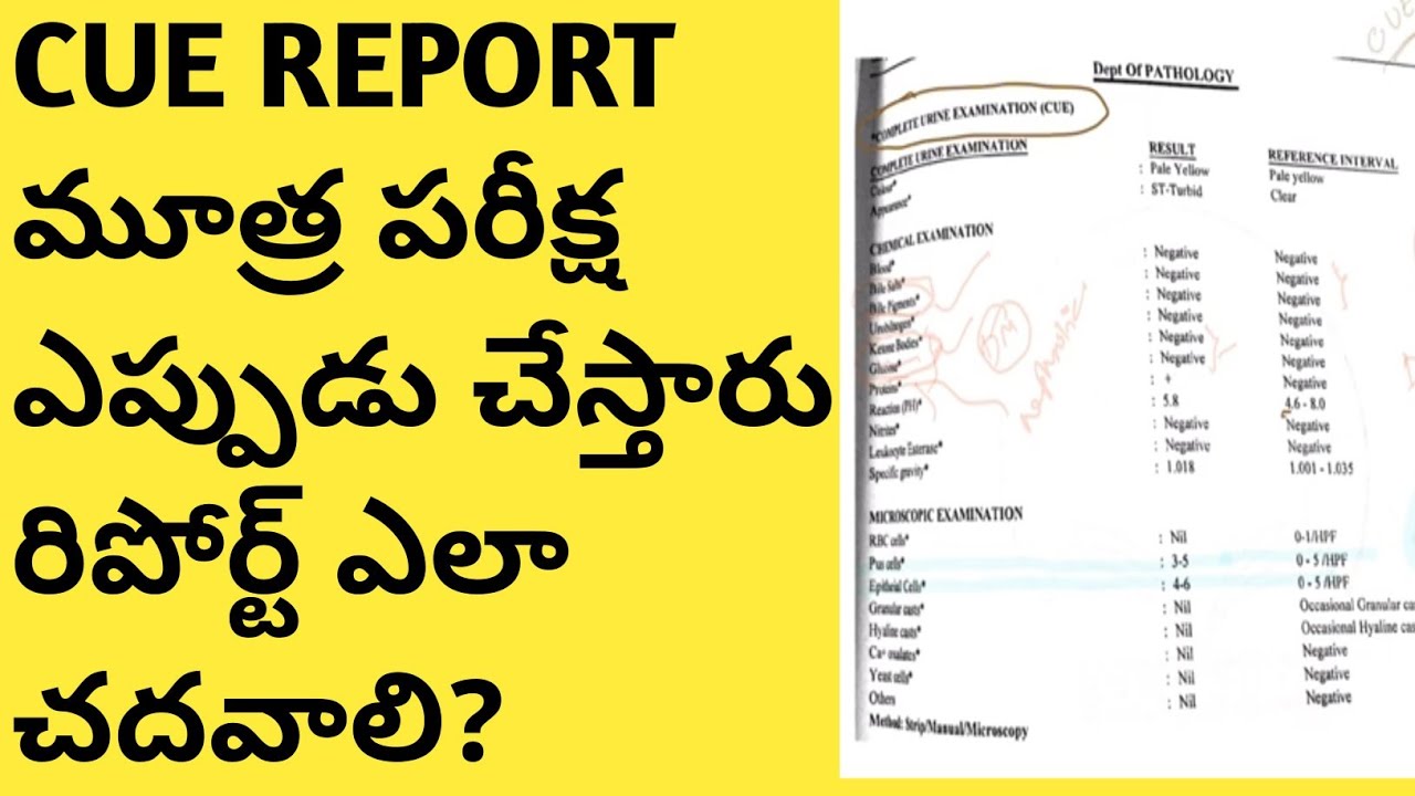 Urine Test In Telugu How To Read Cue Report In Telugu urine Analysis In urine-test-in-telugu-how-to-read-cue-report-in-telugu-urine-analysis-in