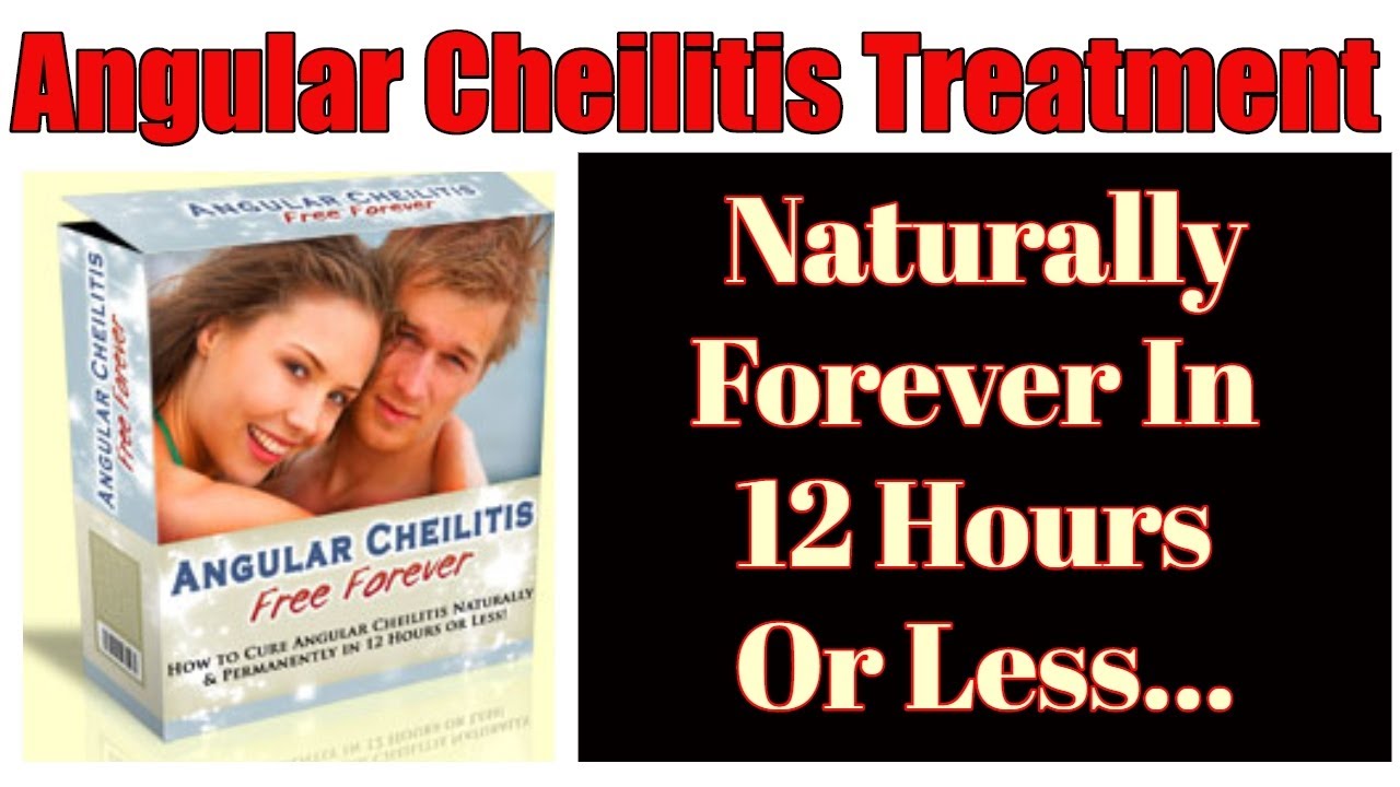 Angular Cheilitis | Angular Cheilitis Treatment | What Causes Angular Cheilitis | Angular ...