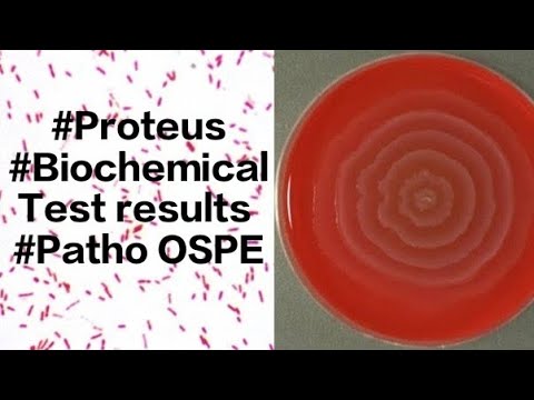 Proteus Tests results (TSI, Motility Indole, Citrate) - YouTube