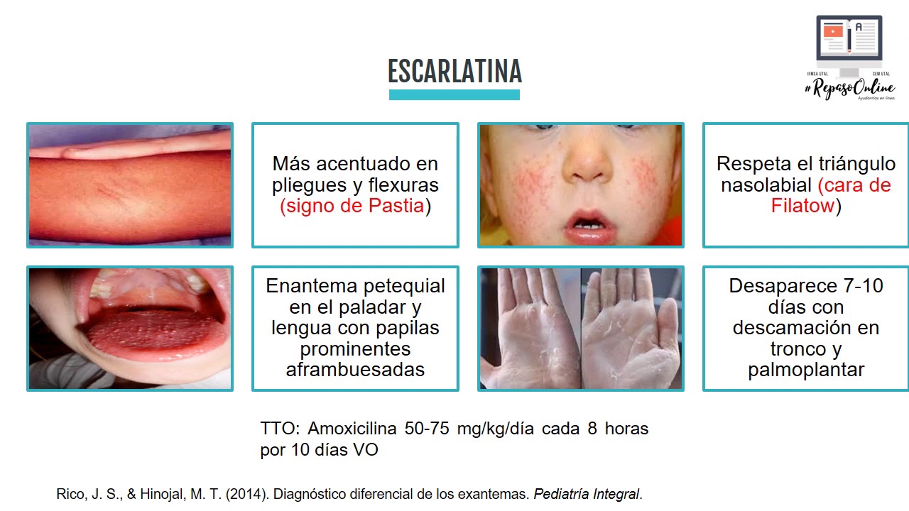 Exantemas en Pediatría - YouTube