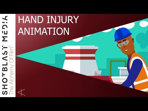 Safety Explainer 2D Animated Corporate Video Hand Injury Health and ...