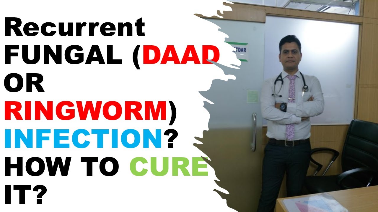 Recurrent FUNGAL (DAAD OR RINGWORM) INFECTION? HOW TO CURE IT? (Dr ...