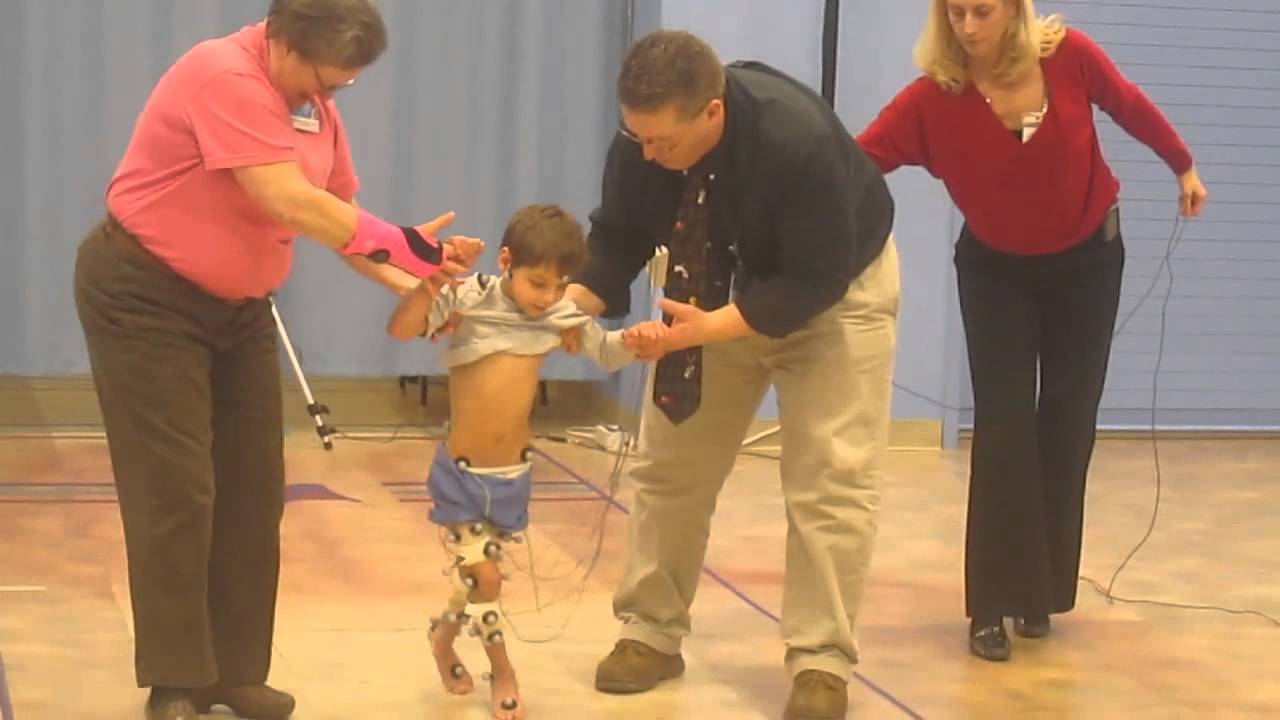 Alex's Mayo Clinic Gait Analysis Lab | Hold On Tight! | Pediatric ...