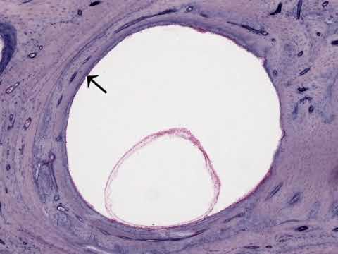 8 El laberinto membranoso y los fluidos del oído interno - YouTube