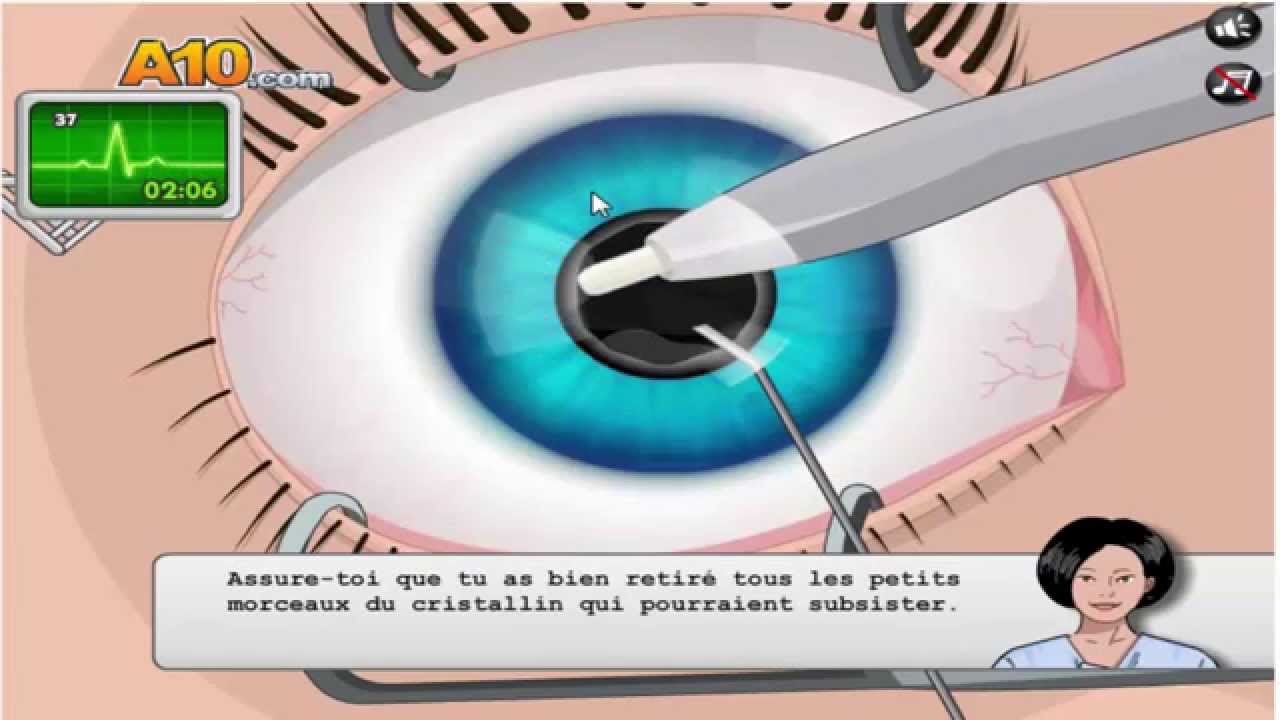 OPERATE NOW : EYE SURGERY - YouTube