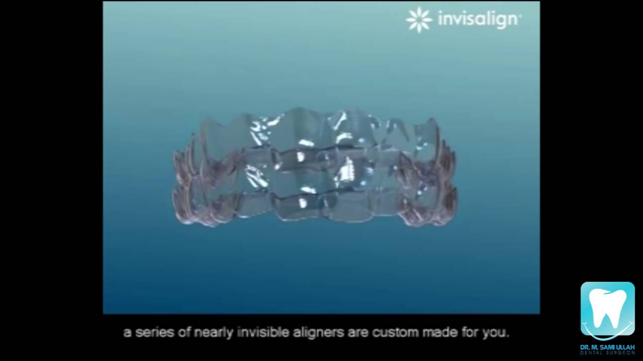 The Invisalign Process - YouTube