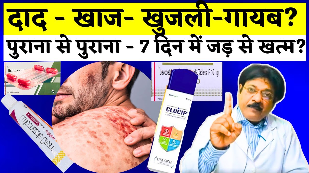 Dad Khaj Khujli Ki Dawa | दाद खाज खुजली जड़ से ख़तम कैसे करे | 4 Best ...