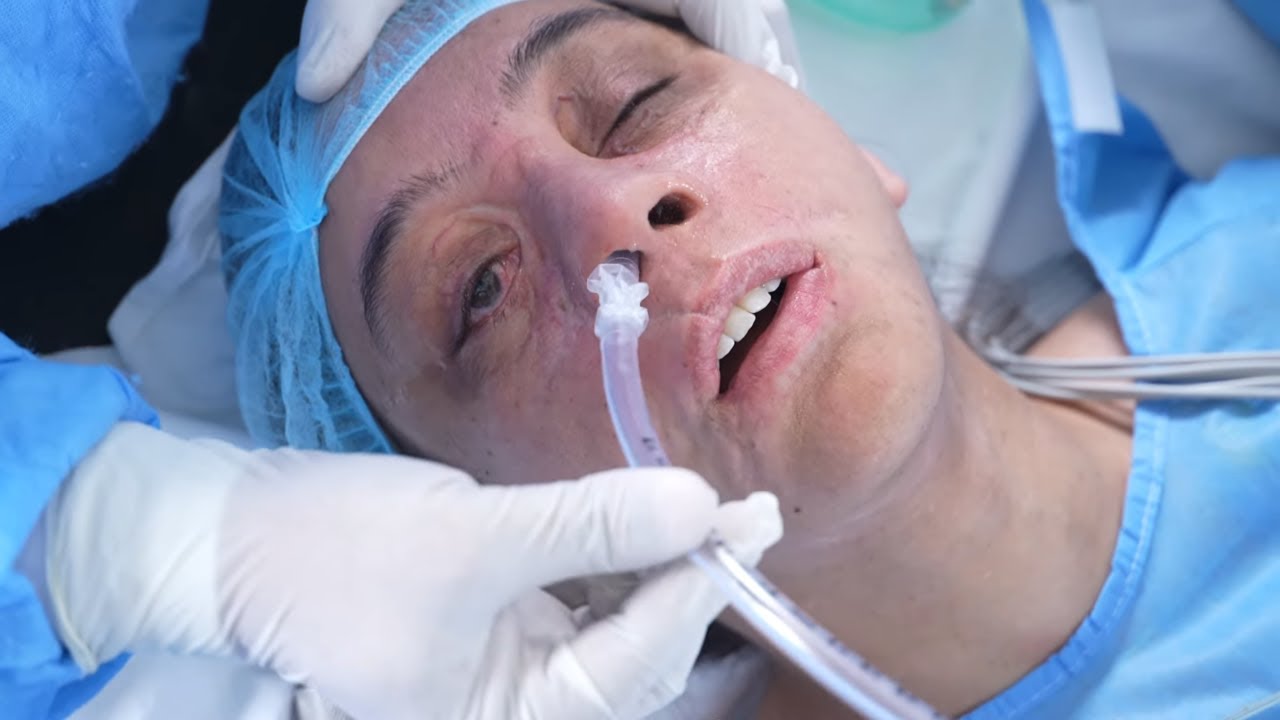 Face Reconstruction Patient going under Anesthesia before Surgery - YouTube