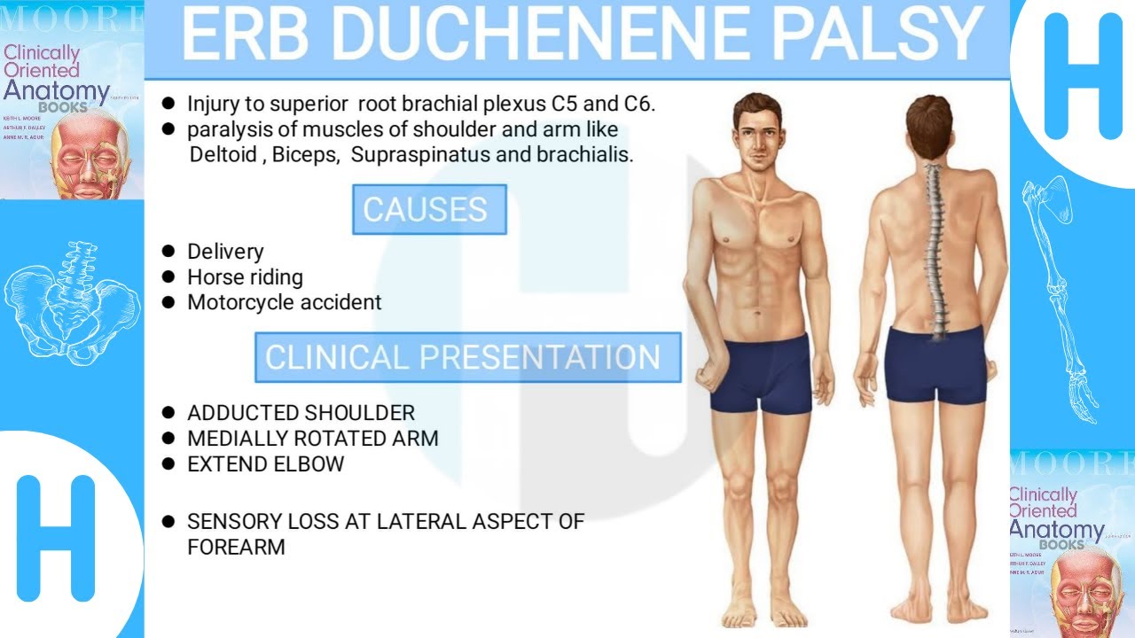 Erb's Duchenne palsy-Upper limb clinicals(brief explanation) Erb's ...