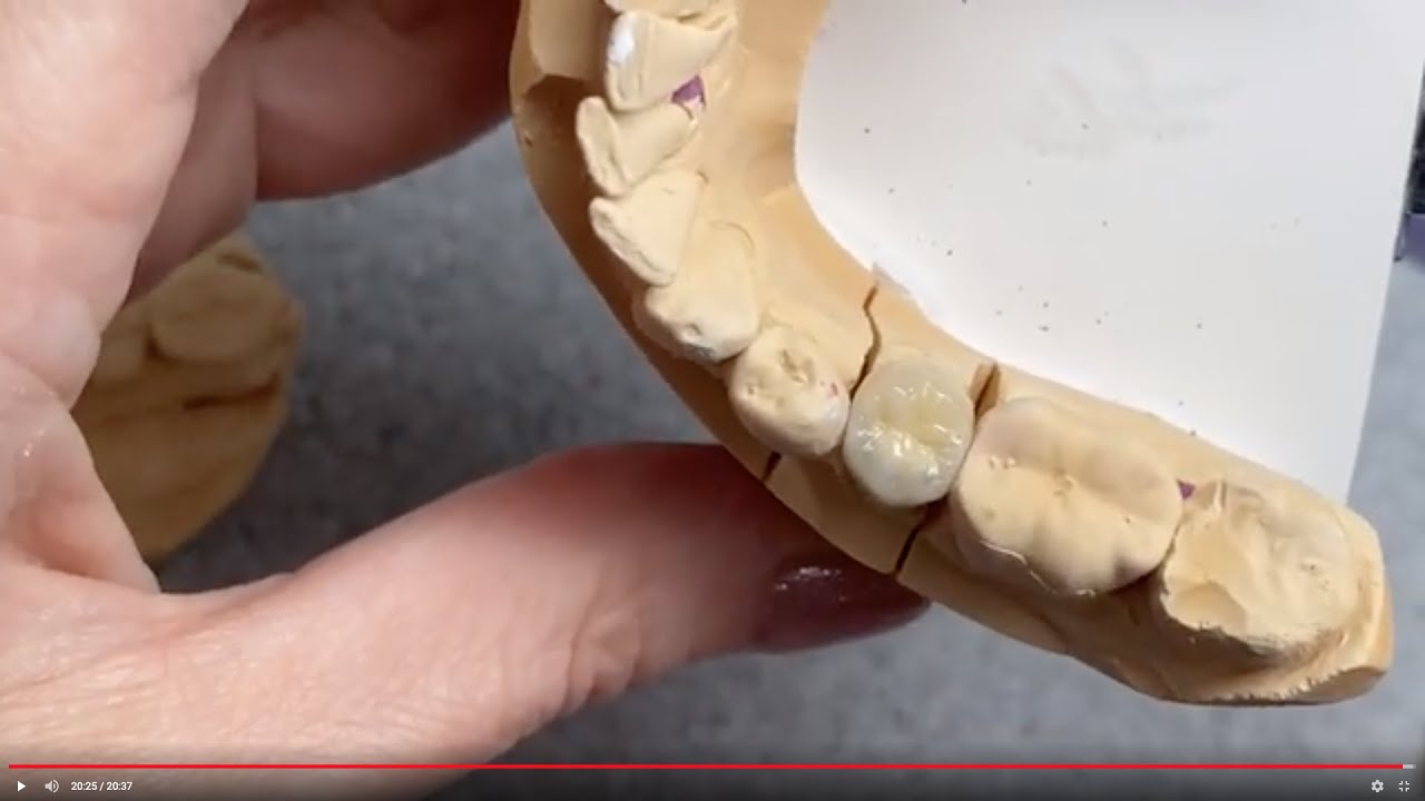 Crown #20 Buildup Initial MC Start to Finish - YouTube