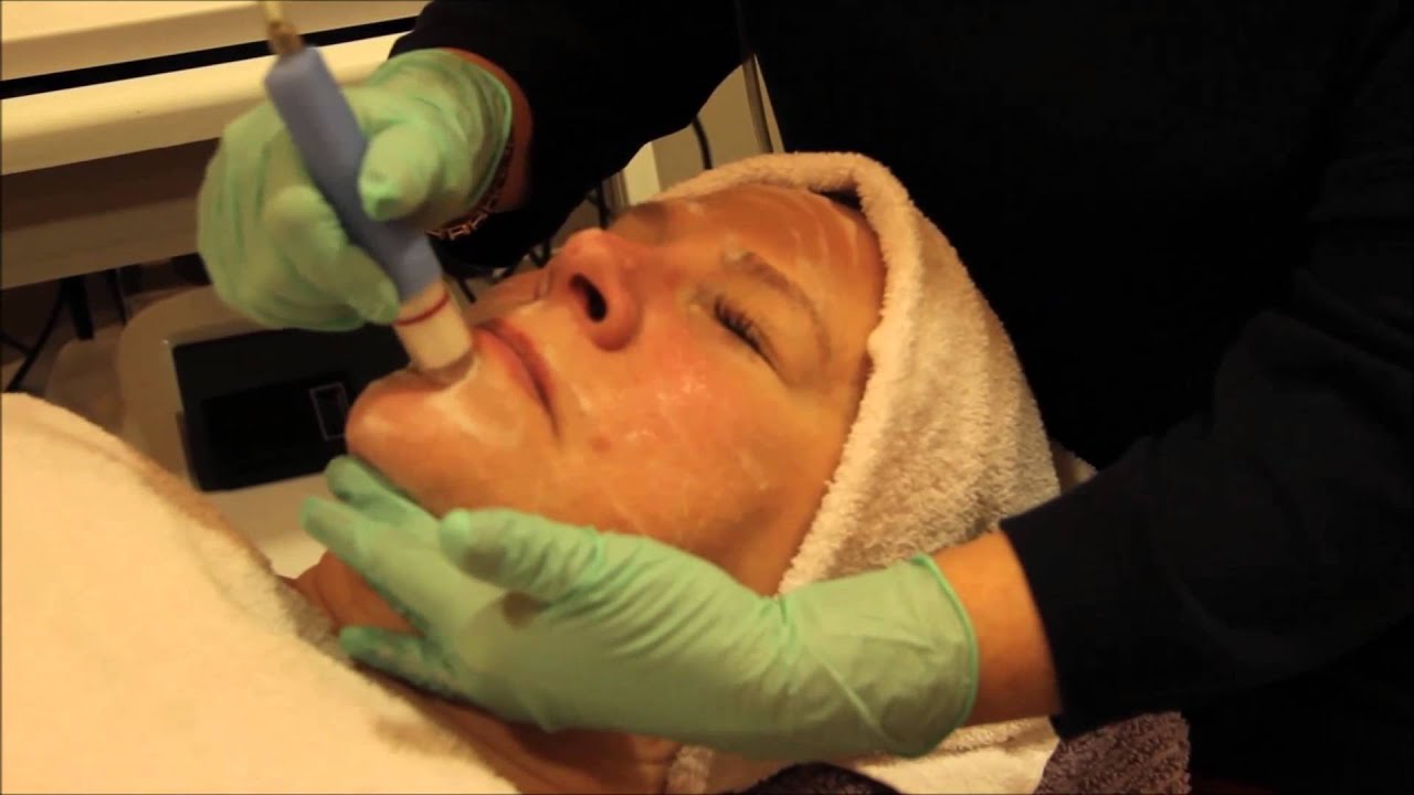 Wet Diamond Dermal Abrasion - YouTube