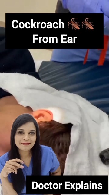 Cockroach in Ear #drnalliramya #earcare #cockroach #earwaxtreatment # ...