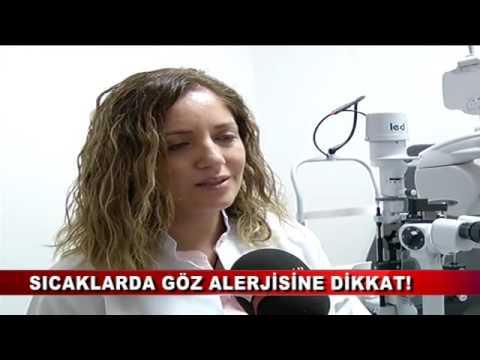 SICAKLARDA GÖZ ALERJİSİNE DİKKAT! (21.07.2016-BOLU)