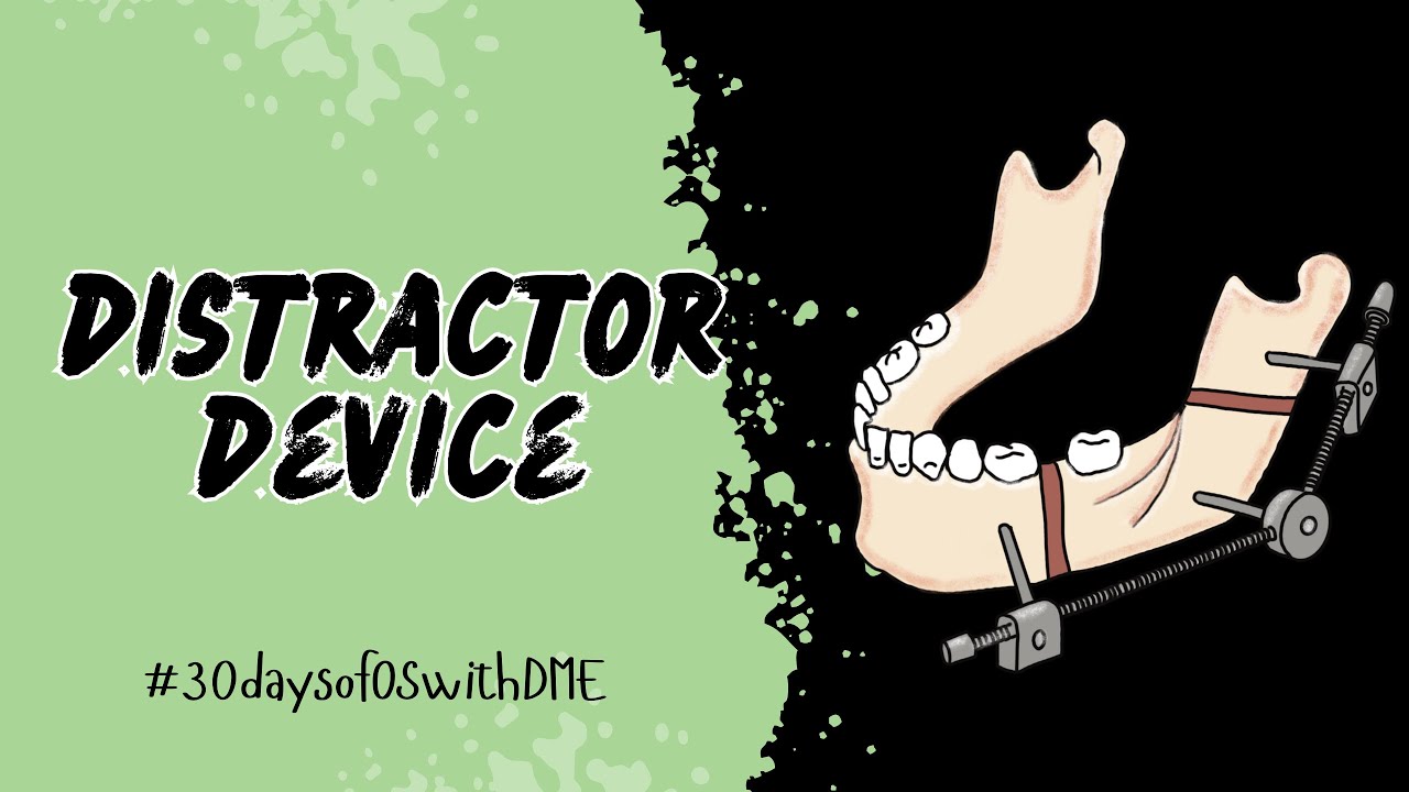 PARTS OF DISTRACTOR || Distraction Osteogenesis || 30daysofOSwithDME ...