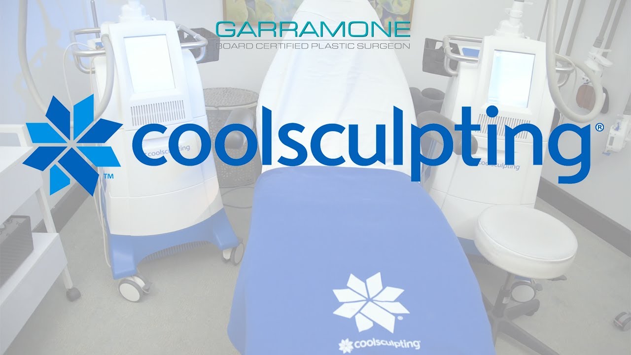 Coolsculpting at Garramone Plastic Surgery - YouTube