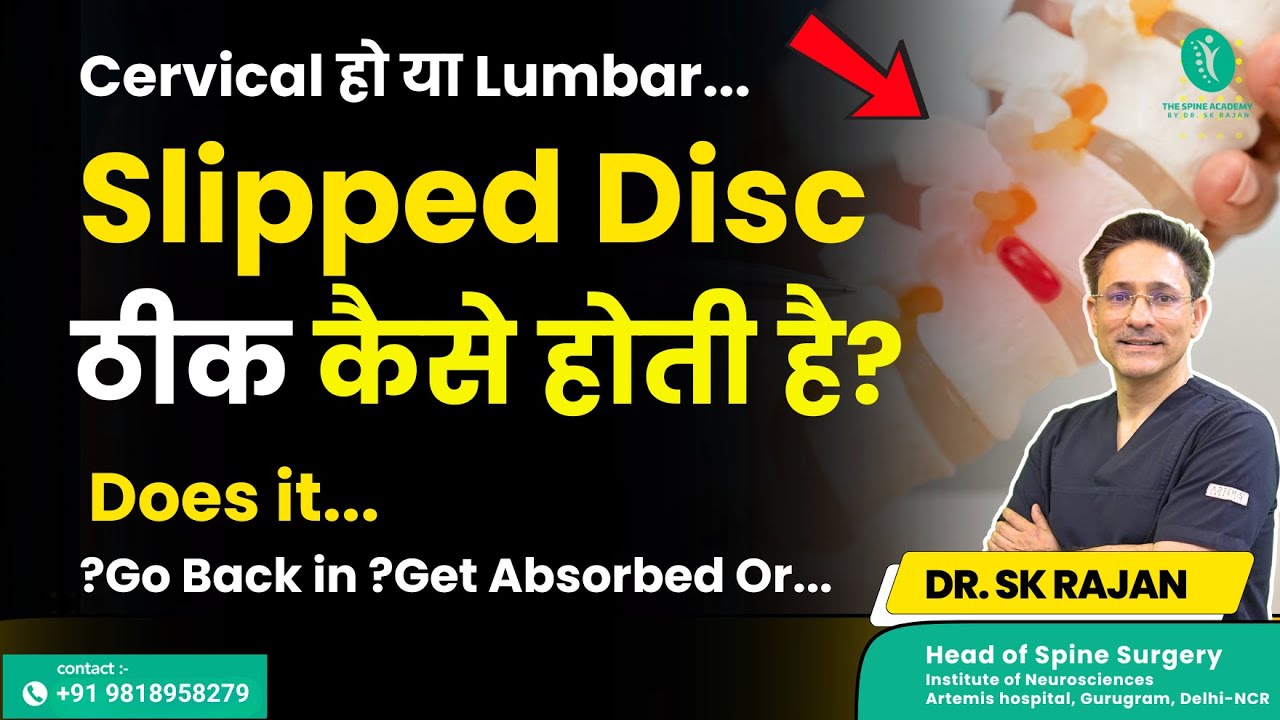 32: How Slipped Disc Heals? Goes Back in or Gets Absorbed ? Real Method ...