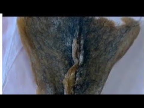 Brazilian sugaring waxing|| waxing her beards for the first time