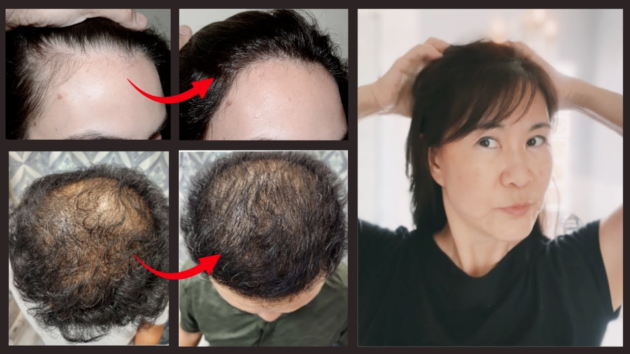 Simple and Yet Powerful Techniques to Massage your Scalp for the ...