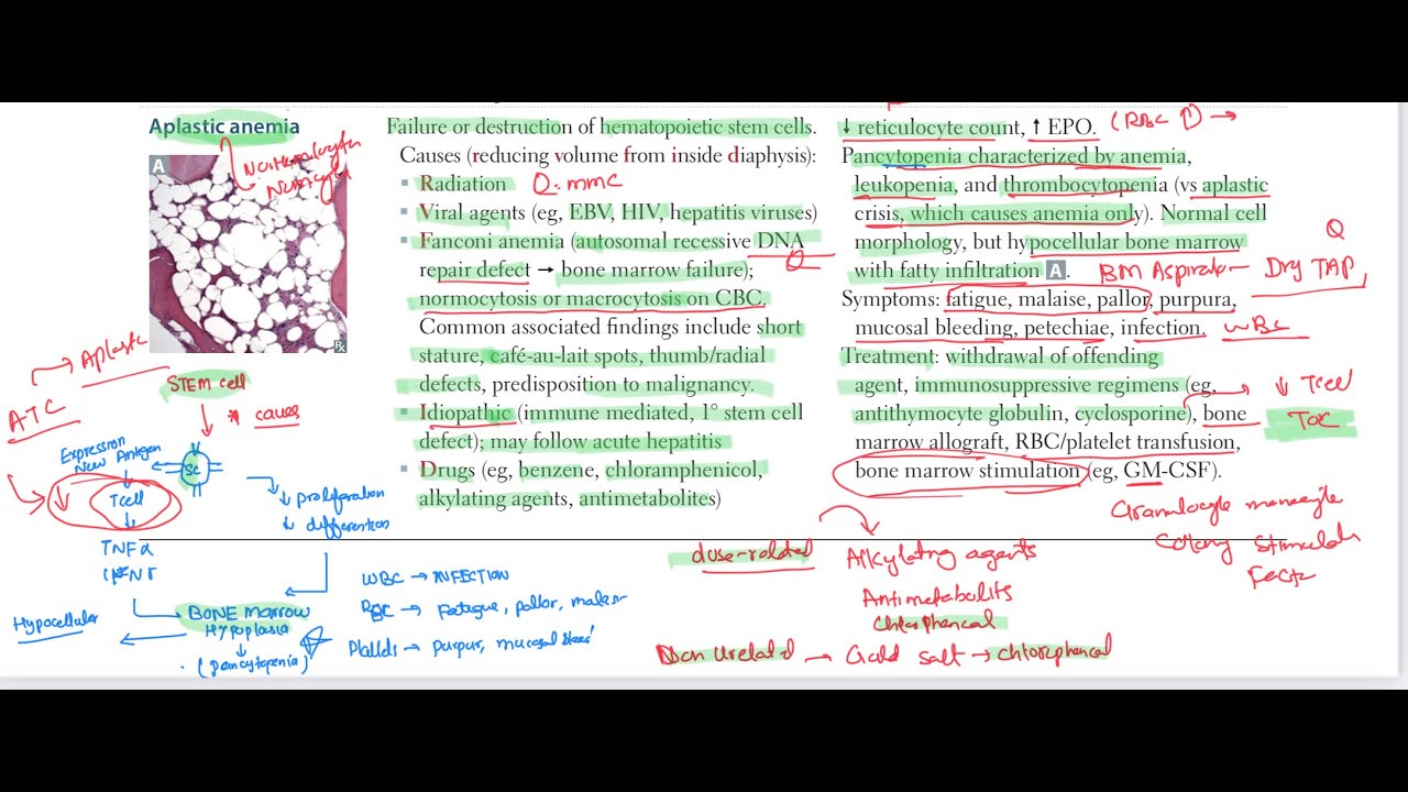 Aplastic anemia #haematology 46 #First Aid USMLE Step 1 in Urdu/Hindi ...