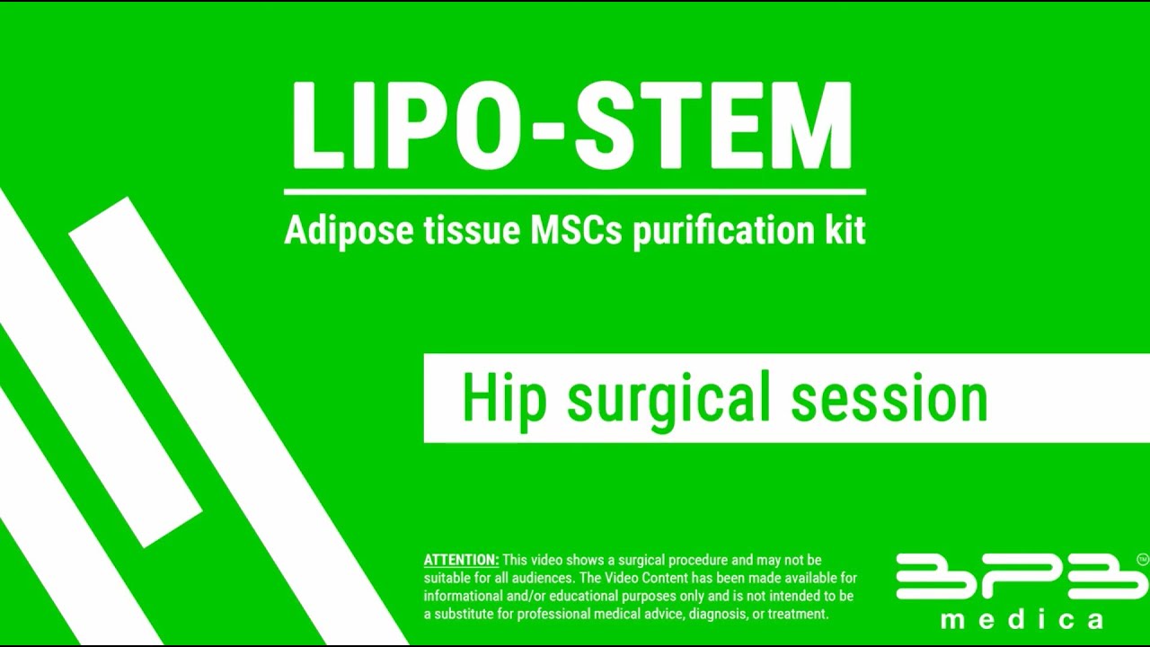 LIPO-STEM™ Лечение остеоартроза мезенхимальными стволовыми клетками ...