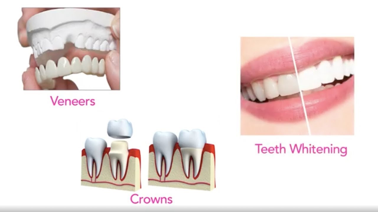 Cosmetic Dentistry Cedar Rapids, IA | Dental Arts Dr. Deb Cassill - YouTube