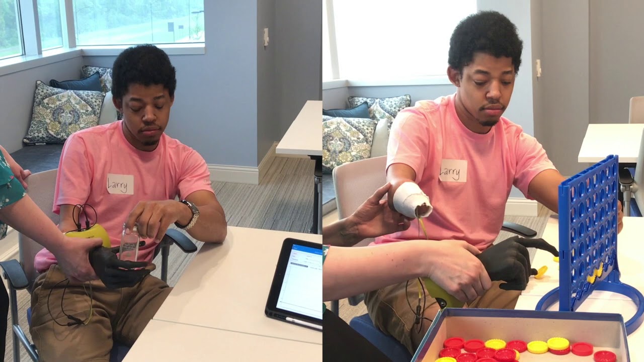 Touch Bionics | New Hope Prosthetics - YouTube