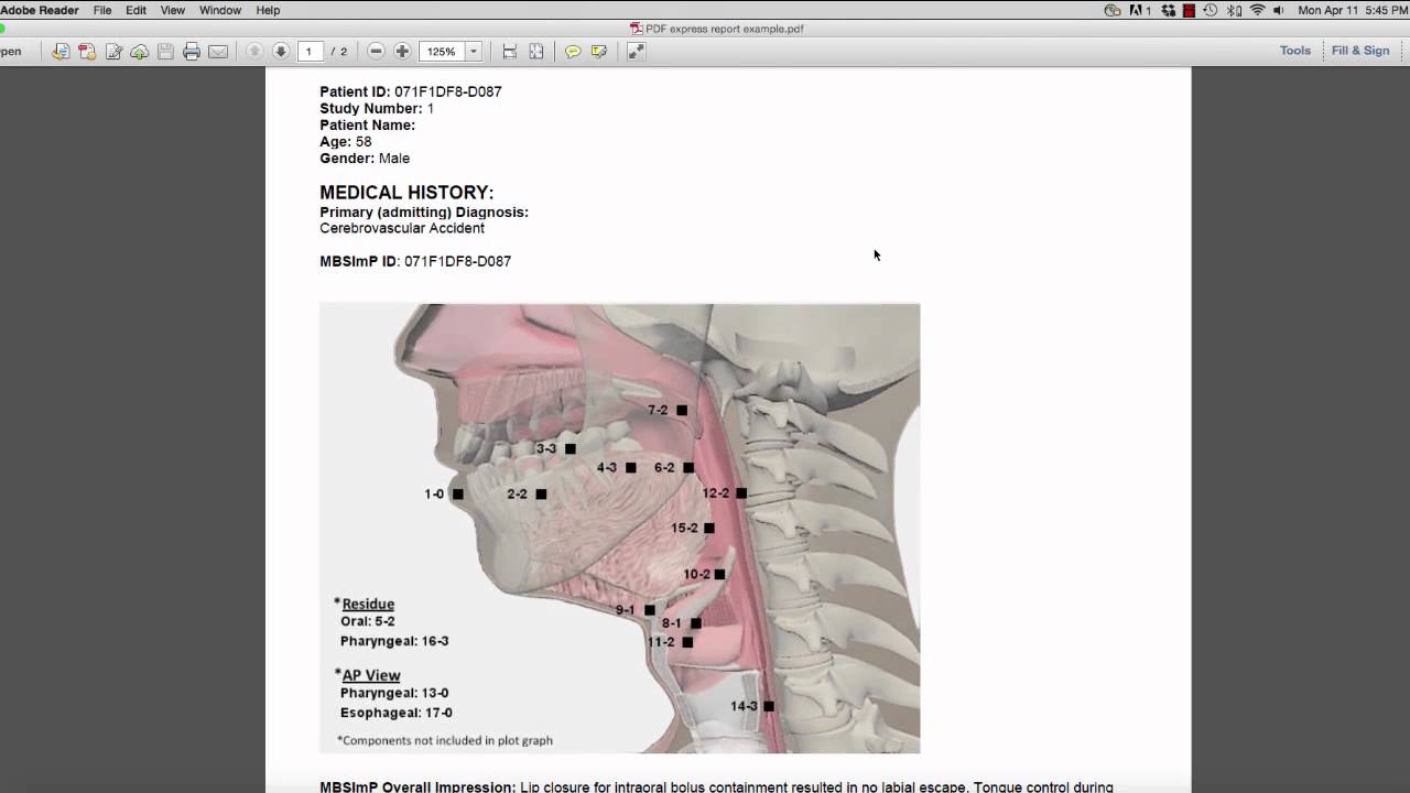 MBSImP Overview - Express Report Templates - YouTube