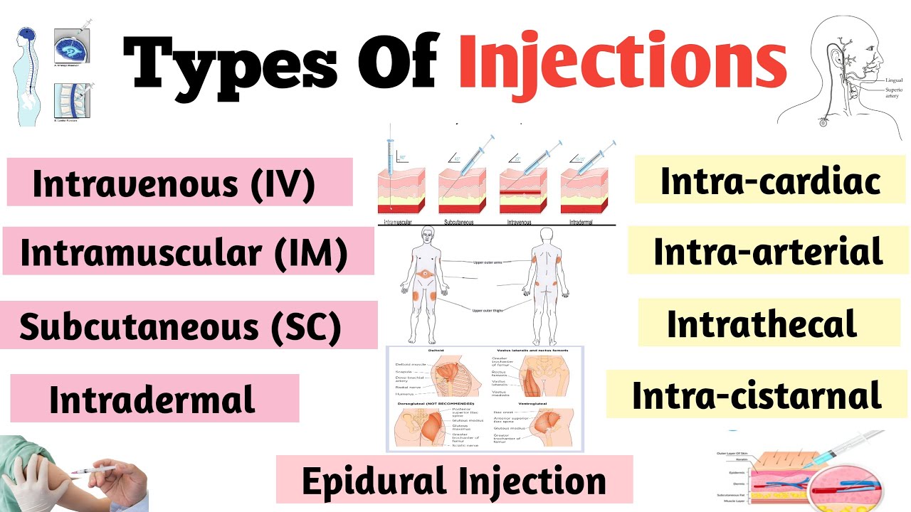 Types Of Injection | Injections Site | Route Of Injections | Hospital ...